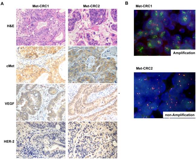 Synergistic antitumor effects of cMet inhibitor in combination with ...