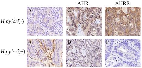 Involvement of Aryl Hydrocarbon Receptor and Aryl Hydrocarbon Receptor ...