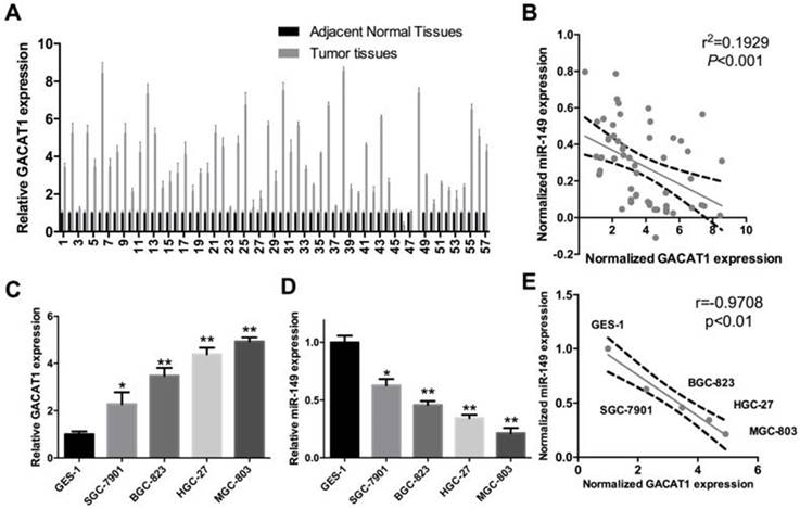 LncRNA GACAT1 Promotes Gastric Cancer Cell Growth, Invasion And ...