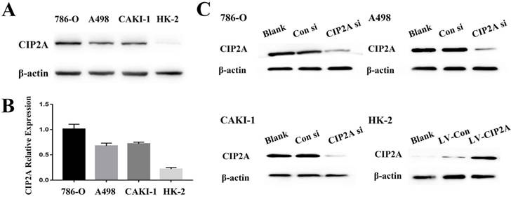 CIP2A Promotes Proliferation, Invasion and Chemoresistance to Cisplatin ...