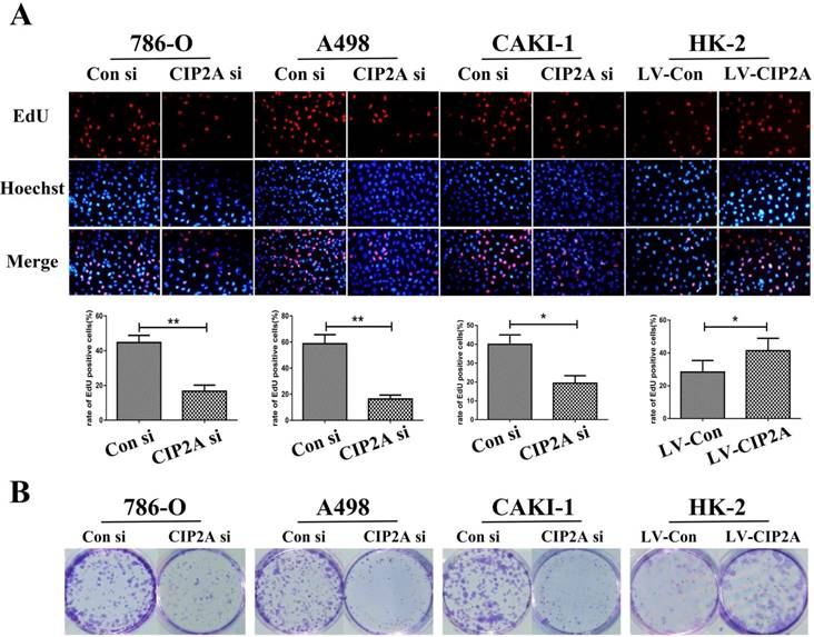 CIP2A Promotes Proliferation, Invasion and Chemoresistance to Cisplatin ...