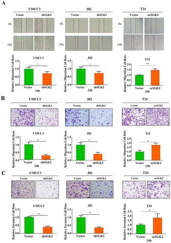Glucocorticoid-Inducible Kinase 2 Promotes Bladder Cancer Cell ...