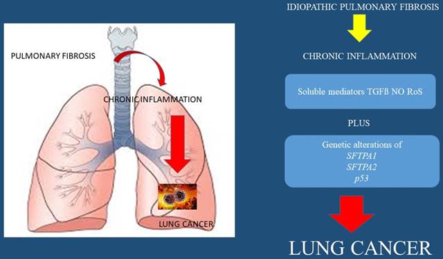 Scar tissue to lung cancer; pathways and treatment