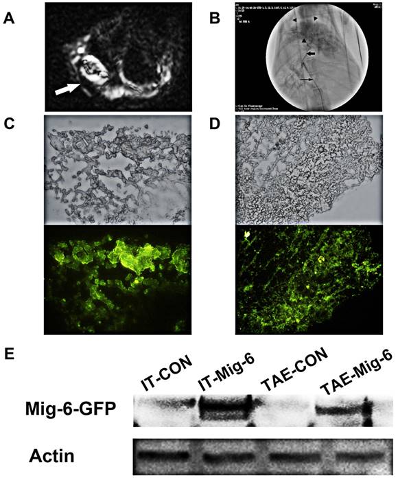 AAV-Mig-6 Increase the Efficacy of TAE in VX2 Rabbit Model, Is ...