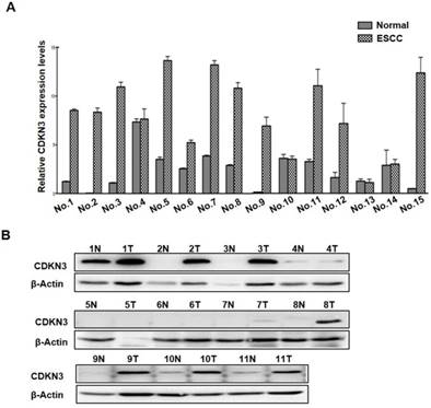 Cyclin-Dependent Kinase Inhibitor 3 Promoted Cell Proliferation by ...