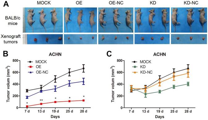 Tropomyosin-1 Functions as a Tumor Suppressor with Respect to Cell ...