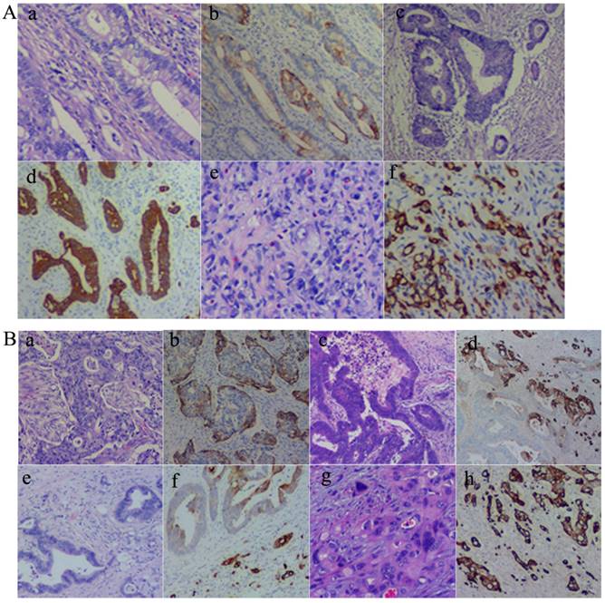 CK7 expression associates with the location, differentiation, lymph ...