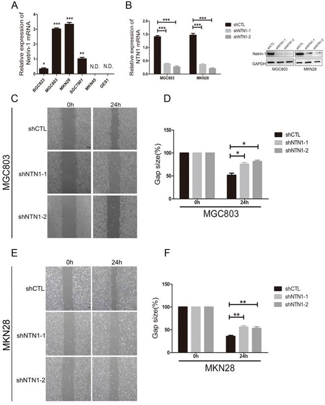 Netrin-1 promotes cell neural invasion in gastric cancer via its ...