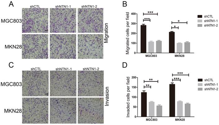 Netrin-1 promotes cell neural invasion in gastric cancer via its ...