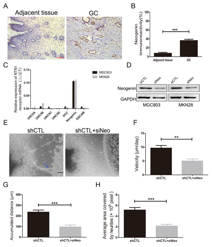 Netrin-1 promotes cell neural invasion in gastric cancer via its ...