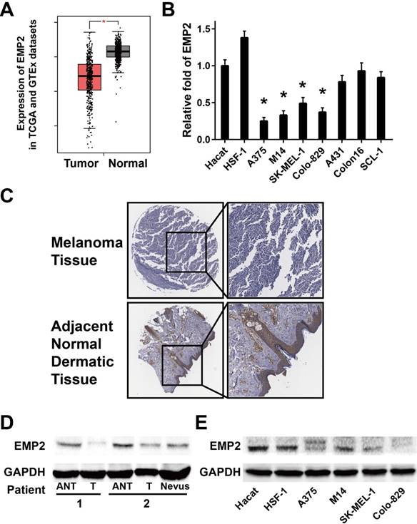 EMP2 acts as a suppressor of melanoma and is negatively regulated by ...