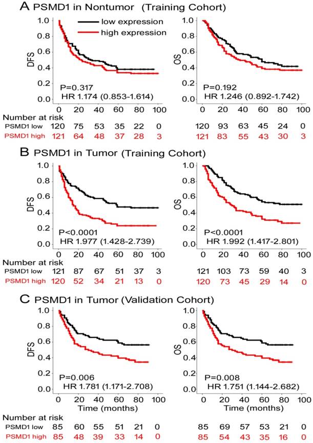Prognostic Significance of PSMD1 Expression in Patients with Gastric Cancer