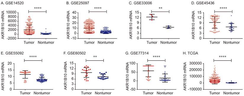 Aldo-Keto Reductase Family 1 Member B10 (AKR1B10) overexpression in ...