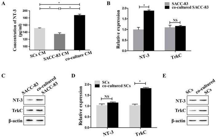 NT-3/TrkC Axis Contributes to the Perineural Invasion and the Poor ...