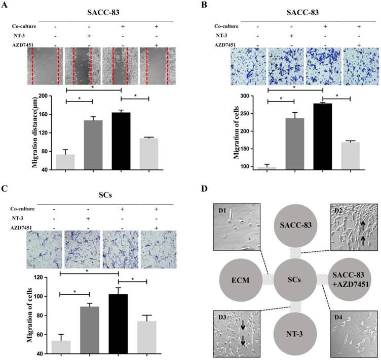 NT-3/TrkC Axis Contributes to the Perineural Invasion and the Poor ...