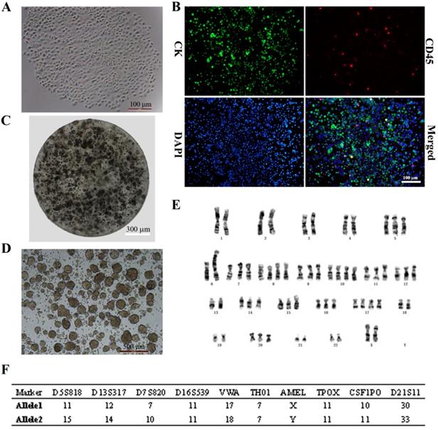 Establishment and Characterization of a CTC Cell Line from Peripheral ...