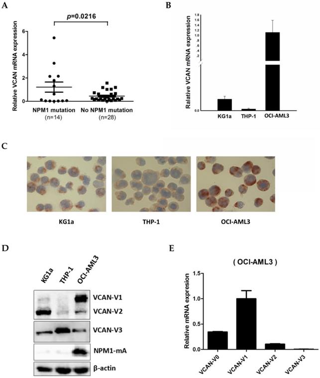 Up-regulation of EMT-related gene VCAN by NPM1 mutant-driven TGF-β/cPML ...