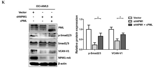 Up-regulation of EMT-related gene VCAN by NPM1 mutant-driven TGF-β/cPML ...