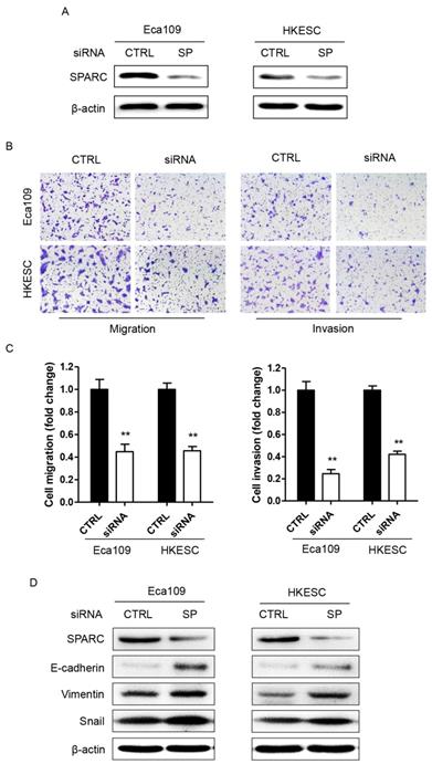 Downregulation of SPARC Expression Decreases Cell Migration and ...