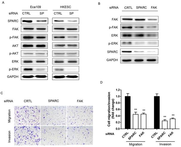 Downregulation of SPARC Expression Decreases Cell Migration and ...