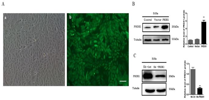 Up-regulation of peroxiredoxin-1 promotes cell proliferation and ...
