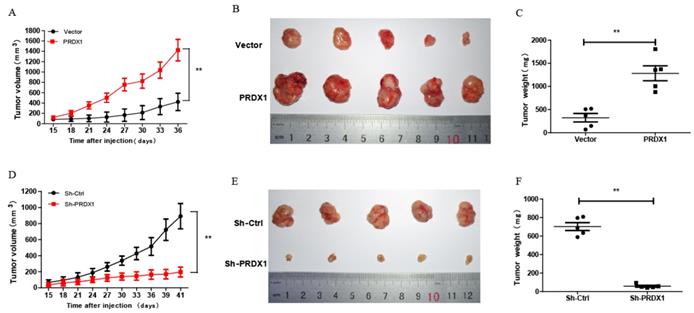 Up-regulation of peroxiredoxin-1 promotes cell proliferation and ...