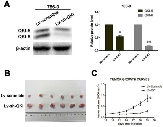 The RNA-binding protein QKI suppresses tumorigenesis of clear cell ...