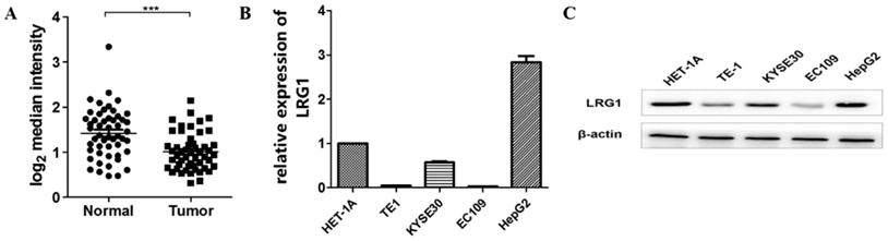 LRG1 Suppresses Migration and Invasion of Esophageal Squamous Cell ...