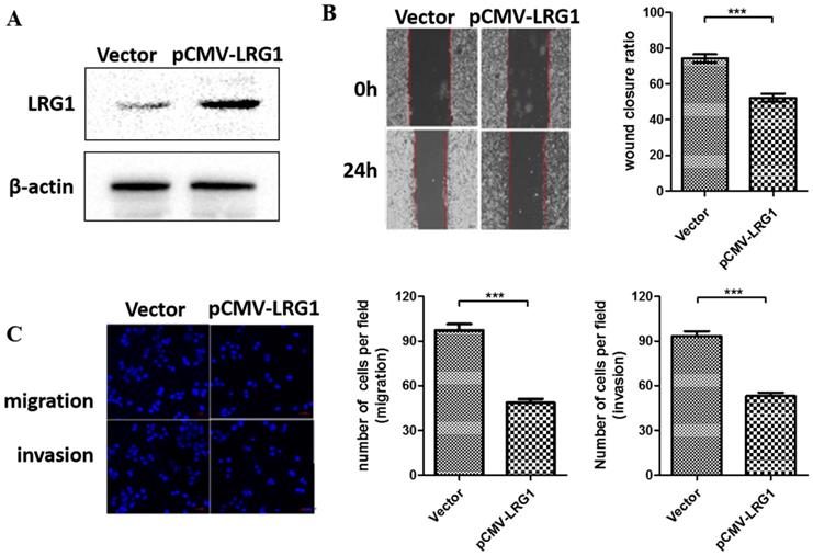 LRG1 Suppresses Migration and Invasion of Esophageal Squamous Cell ...