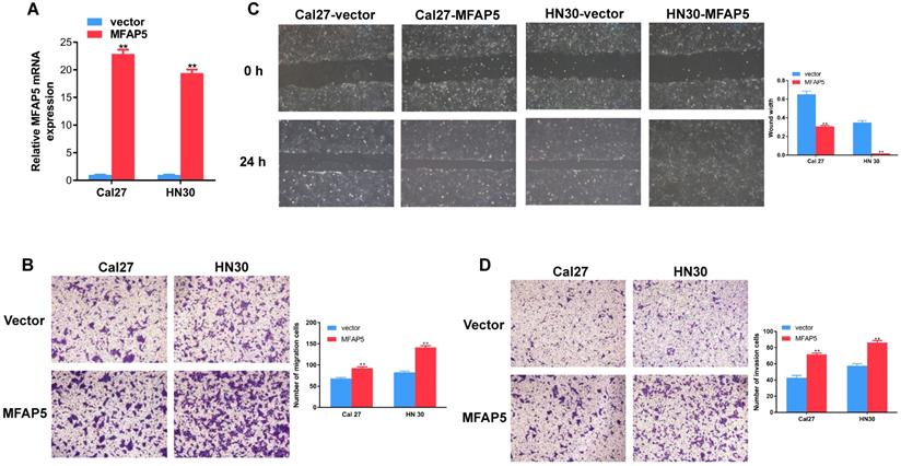 Hypoxia-induced MFAP5 Promotes Tumor Migration and Invasion via AKT ...