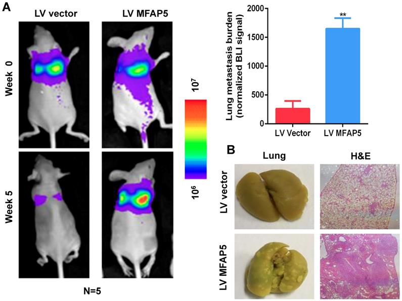 Hypoxia-induced MFAP5 Promotes Tumor Migration and Invasion via AKT ...
