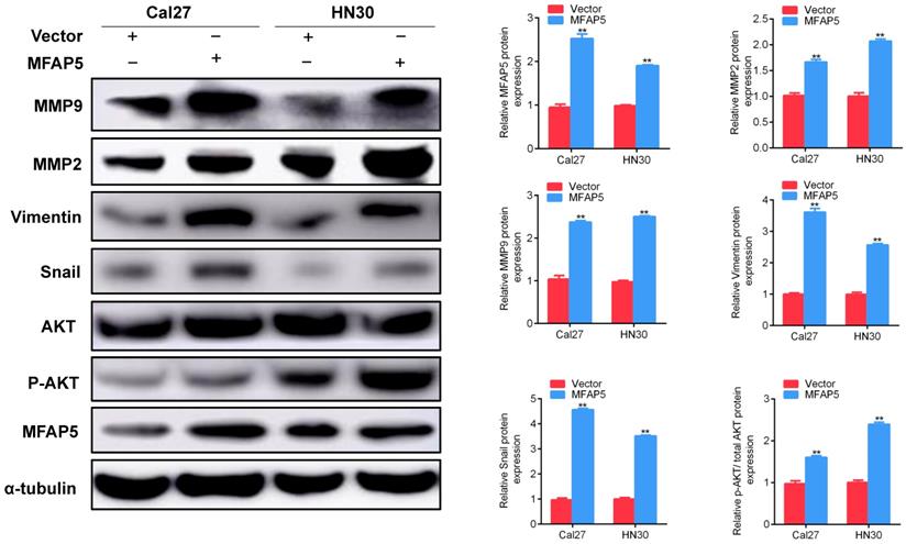 Hypoxia-induced MFAP5 Promotes Tumor Migration and Invasion via AKT ...
