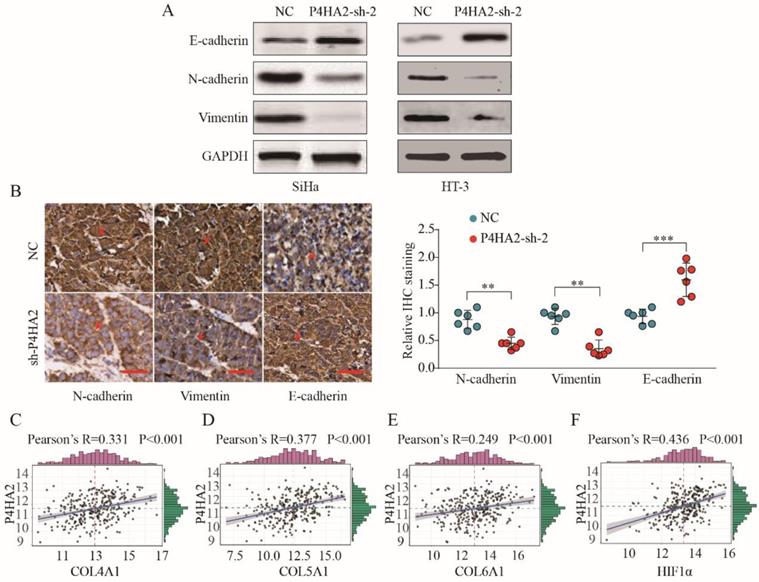 P4HA2 contributes to cervical cancer progression via inducing ...