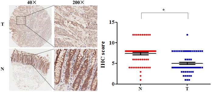 Down-regulated Solute Carrier Family 4 Member 4 Predicts Poor ...