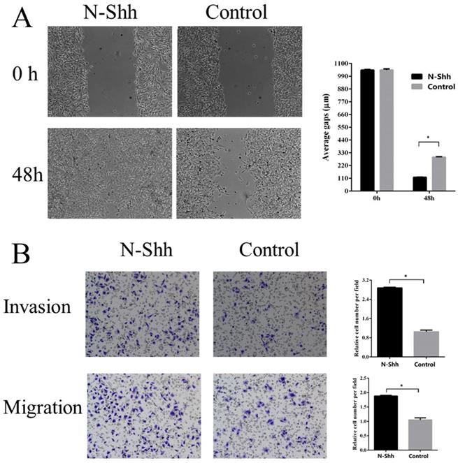 Sonic Hedgehog/Gli1 Signaling Pathway Regulates Cell Migration and ...