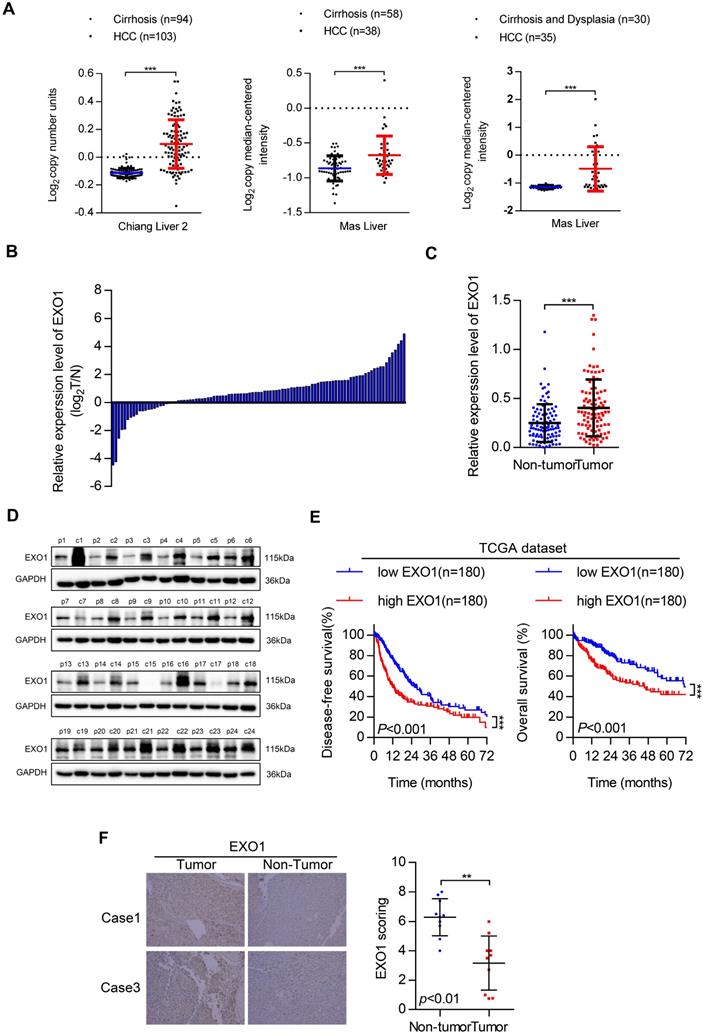 EXO1 Plays a Carcinogenic Role in Hepatocellular Carcinoma and is ...
