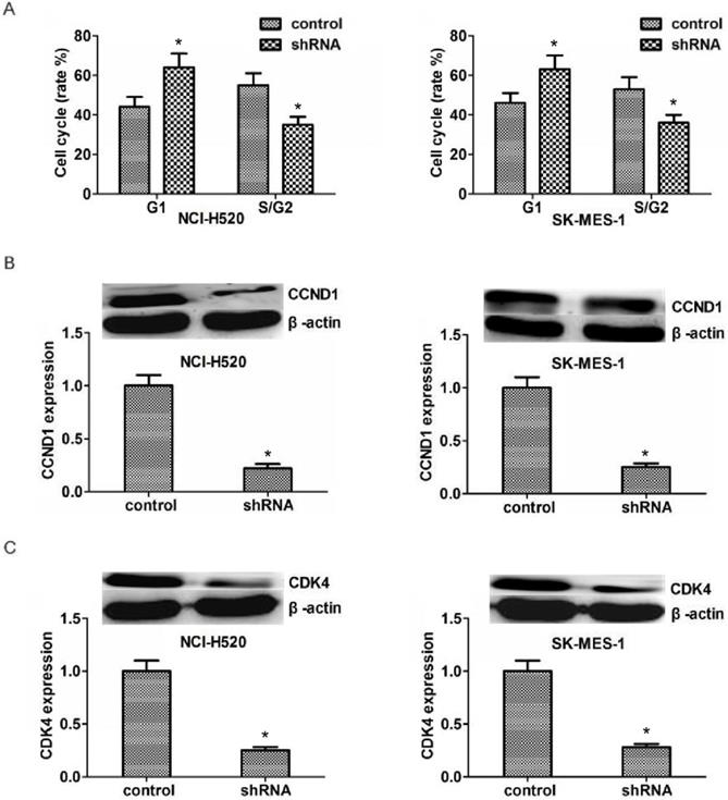 Abnormal spindle-like microcephaly-associated protein (ASPM ...