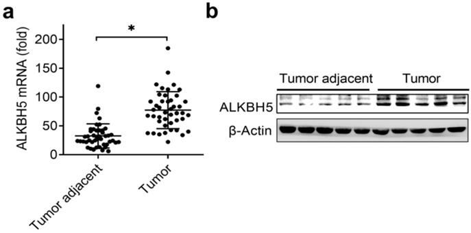 ALKBH5 regulates IGF1R expression to promote the Proliferation and ...