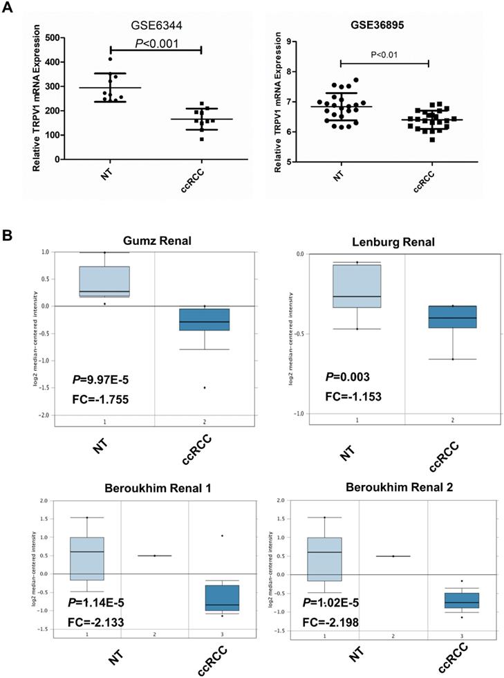 TRPV1 acts as a Tumor Suppressor and is associated with Immune Cell ...