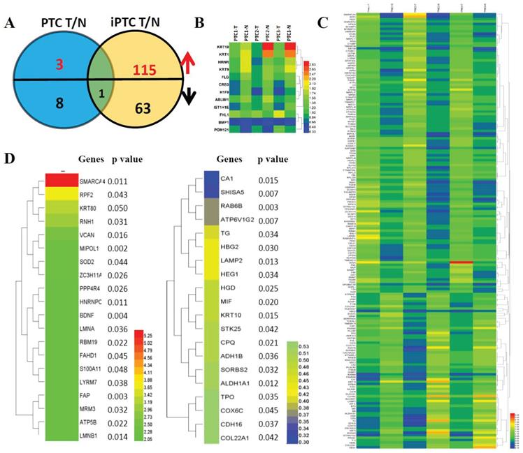 TMT-labeling Proteomics of Papillary Thyroid Carcinoma Reveal Invasive Biomarkers