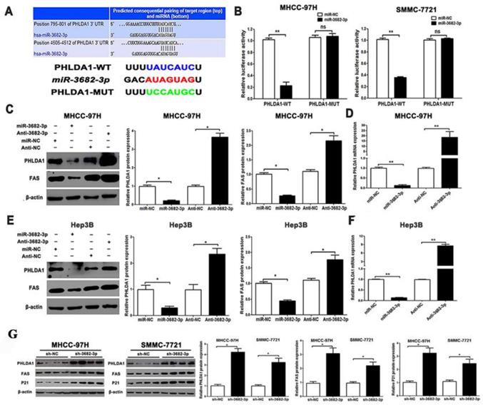High-matrix-stiffness induces promotion of hepatocellular carcinoma ...