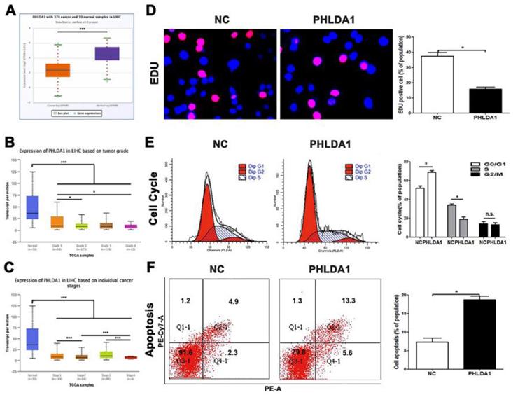 High-matrix-stiffness induces promotion of hepatocellular carcinoma ...