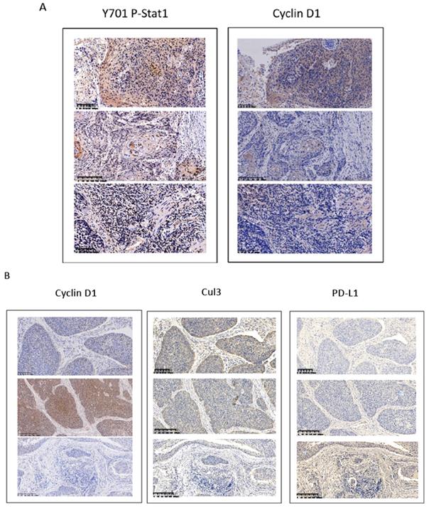 Arsenic trioxide (ATO) induced degradation of Cyclin D1 sensitized PD-1 ...