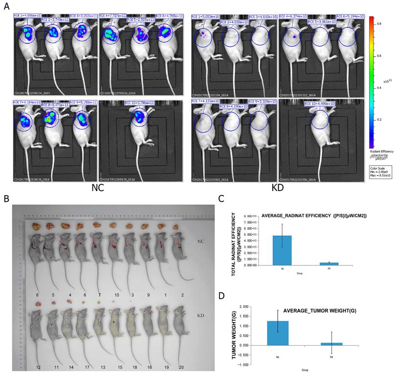 PRIM1 promotes the proliferation of hepatocellular carcinoma cells in ...