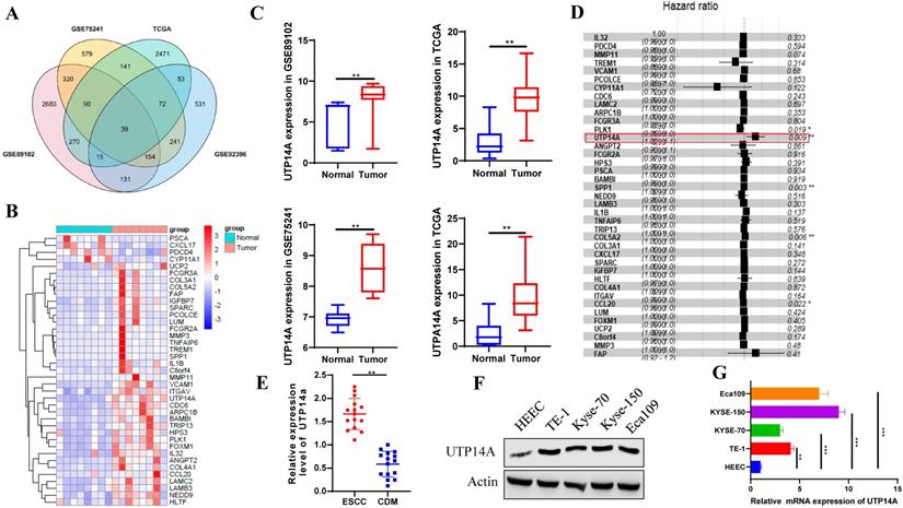 U three protein 14a (UTP14A) promotes tumour proliferation and ...