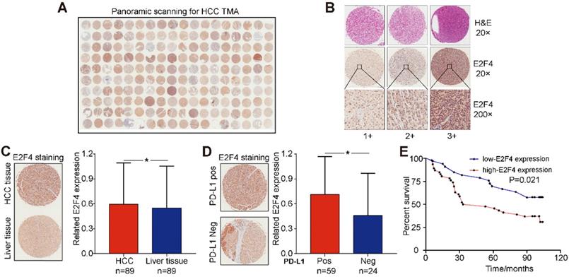 Transcription factor E2F4 is an indicator of poor prognosis and is ...