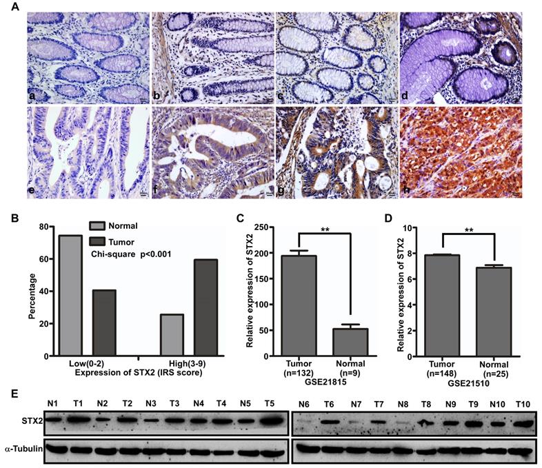 Syntaxin 2 promotes colorectal cancer growth by increasing the ...