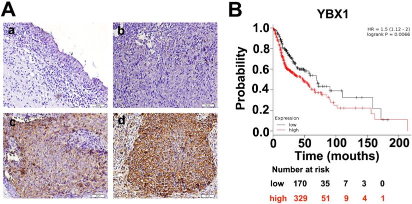 RNA-binding protein YBX1 promotes cell proliferation and invasiveness ...