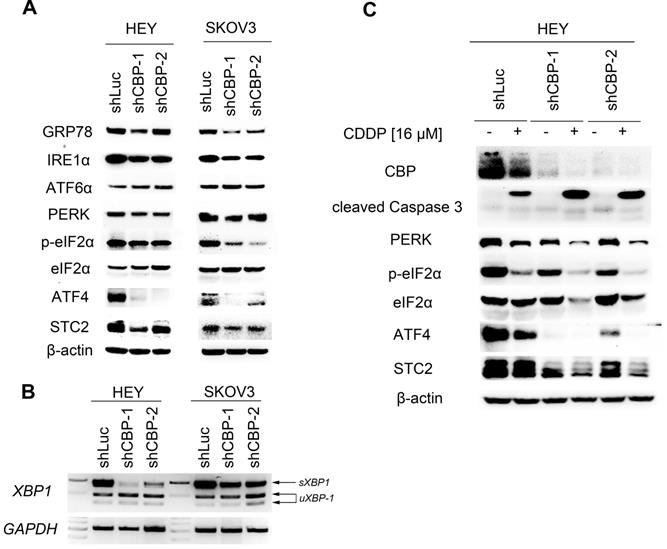 CREBBP knockdown suppressed proliferation and promoted chemo ...