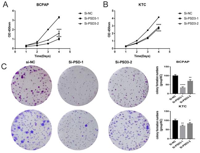 PSD3 is an oncogene that promotes proliferation, migration, invasion ...